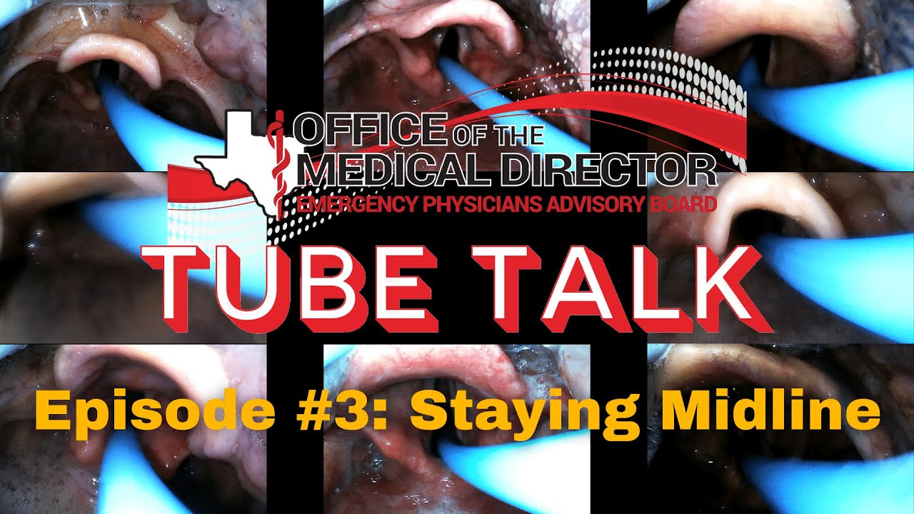 CE - Tube Talk Episode #3 - YouTube