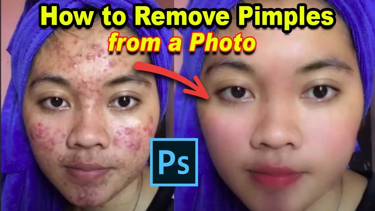 How to Remove Pimples from a Photo in Photoshop | Easy Retouch Tutorial ...