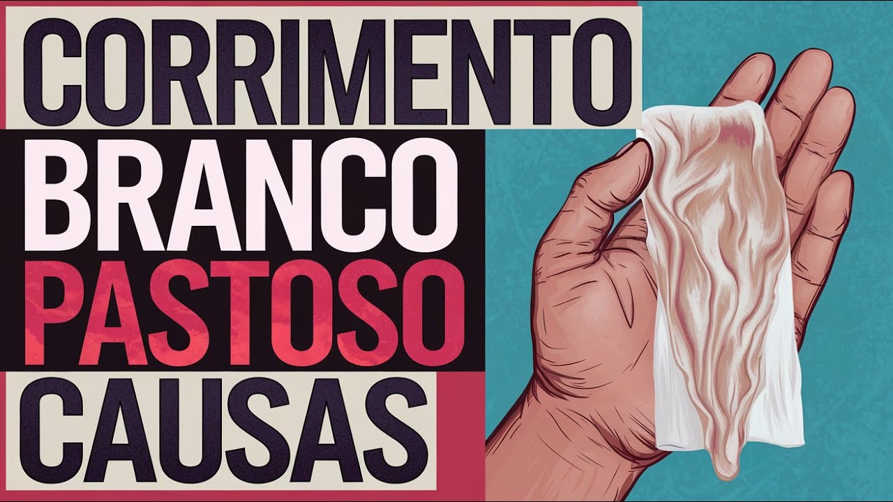 Corrimento Branco Pastoso Causas e Sintomas o que Pode Ser - YouTube