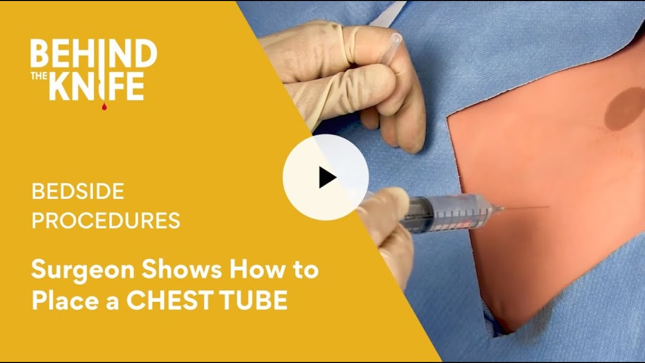 Surgeon Shows How to Place a CHEST TUBE - Behind the Knife - Bedside ...