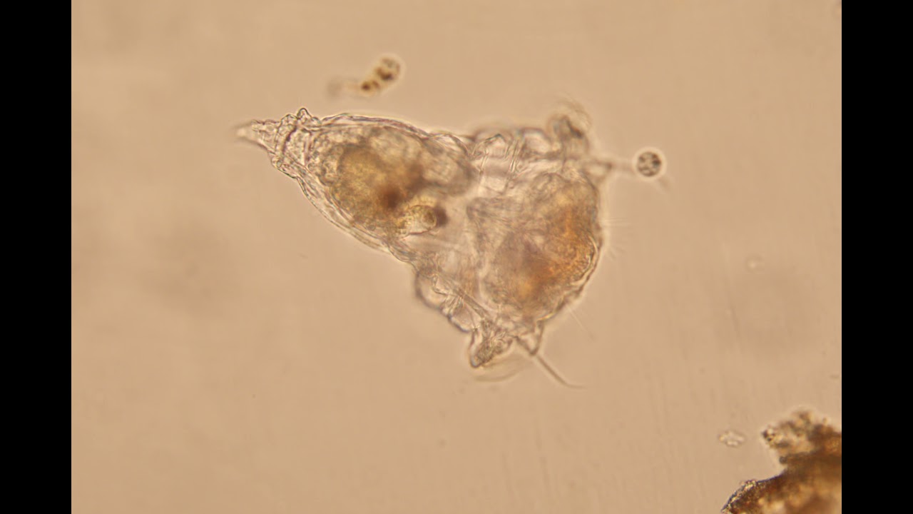 ドロワムシ属の1種 Synchaeta sp. - YouTube