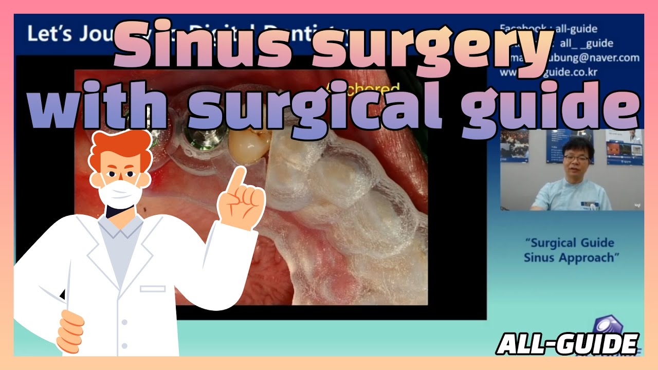 Sinus surgery with surgical guide - YouTube