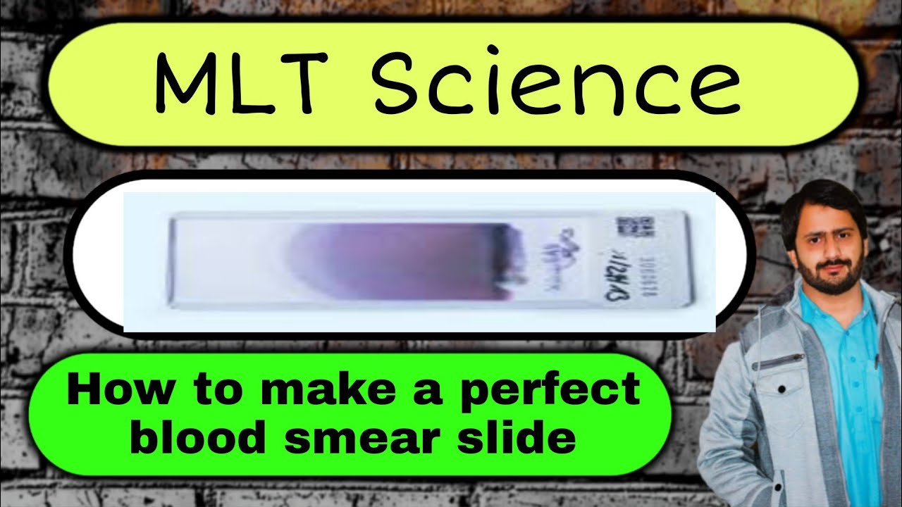 How to prepare blood smear slide method | how blood smear slide ...