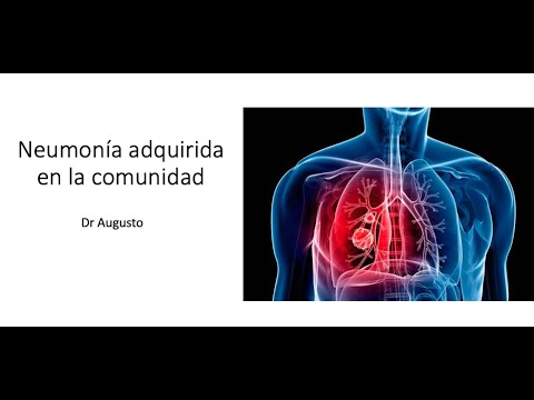 Neumonía adquirida en la comunidad: Microbiología y tratamiento actual ...