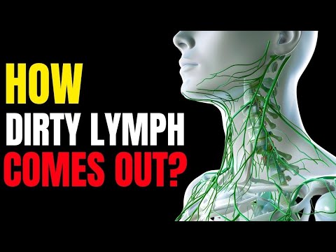 TOP 5 KILLERS OF YOUR LYMPH | How to quickly recognize problems with ...