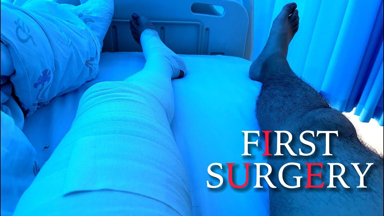 Varicose Veins Surgery (Easy Fix But a PAIN...) - YouTube