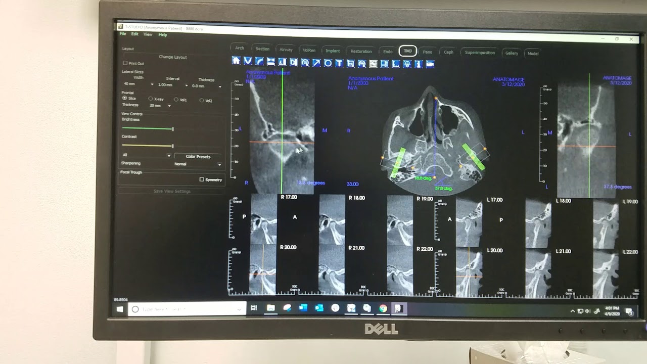An Introduction to Our New X-ray (CBCT) machine - YouTube