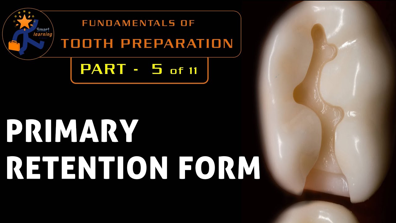 Fundamentals of tooth preparation - Part 5 | Dr Benin - YouTube