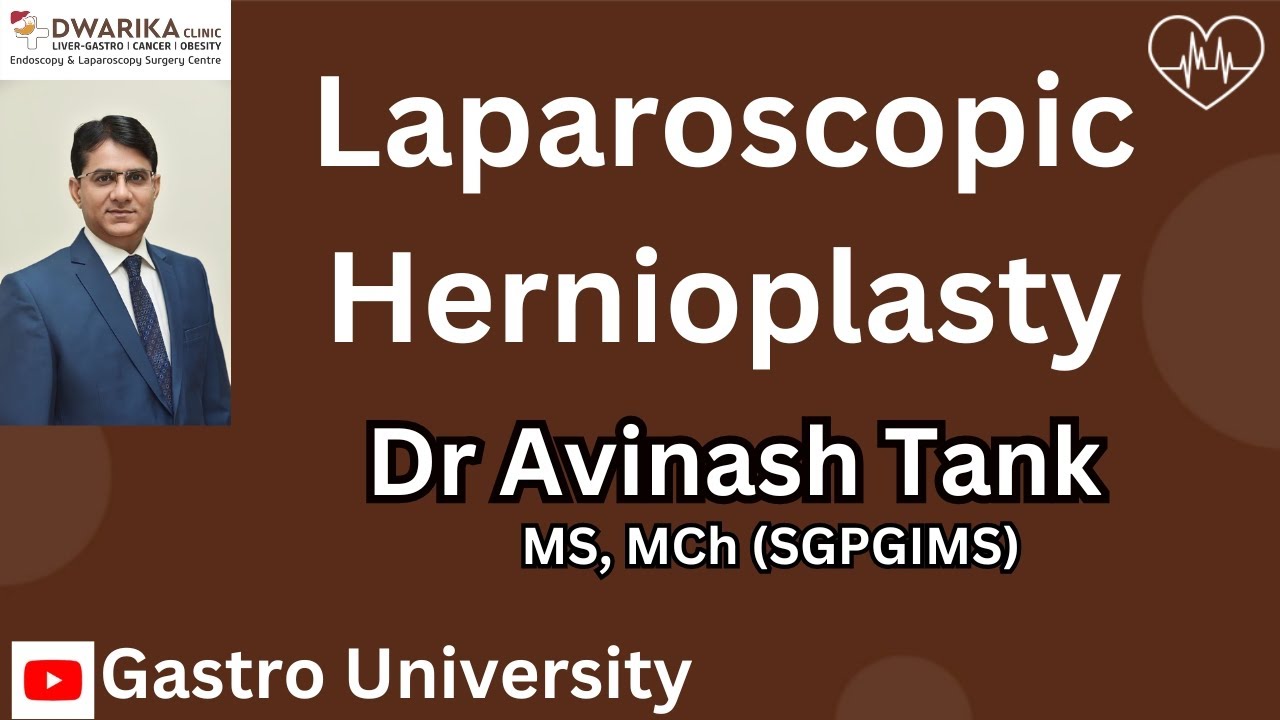 Bilateral TAPP for Inguinal Hernia. #Laparoscopic #Transabdominal ...