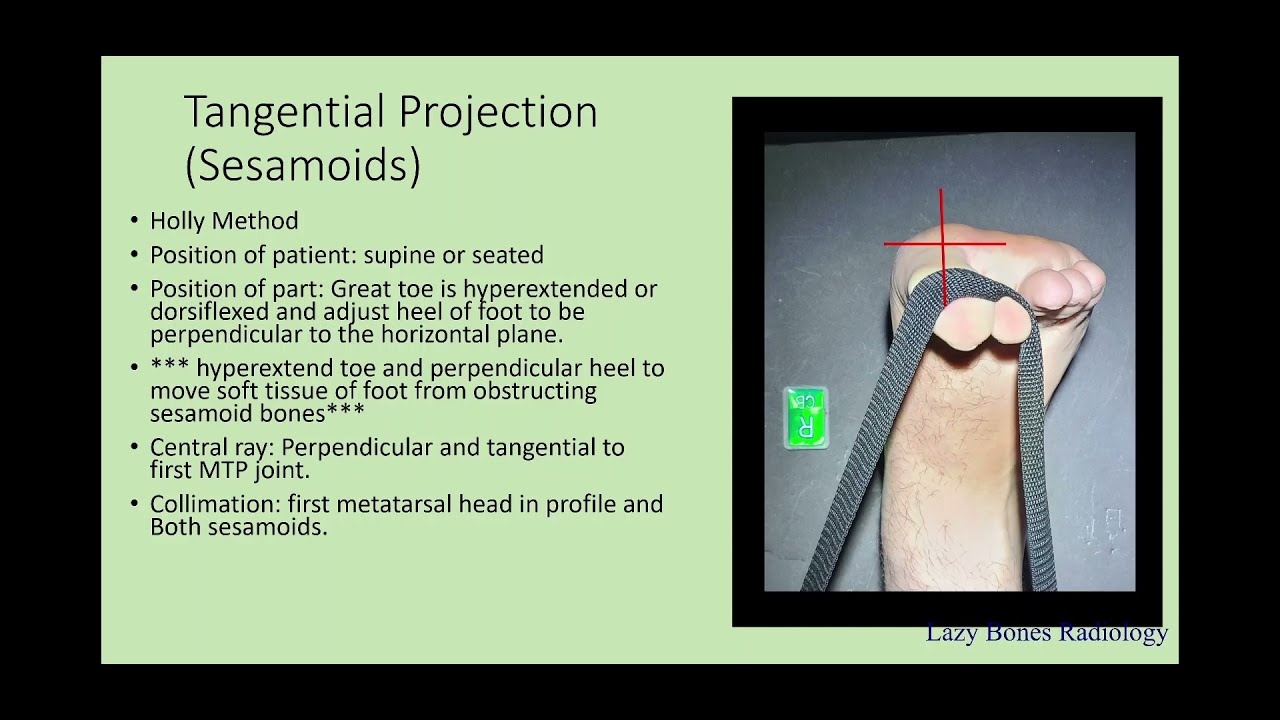 Positioning of the Toes Episode 13 #LazyBonesRadiology - YouTube
