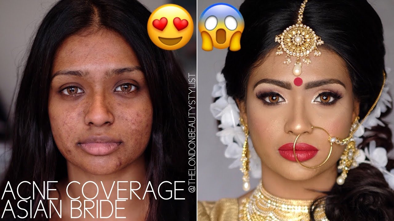ACNE COVERAGE SOUTH INDIAN BRIDAL MAKEOVER - YouTube