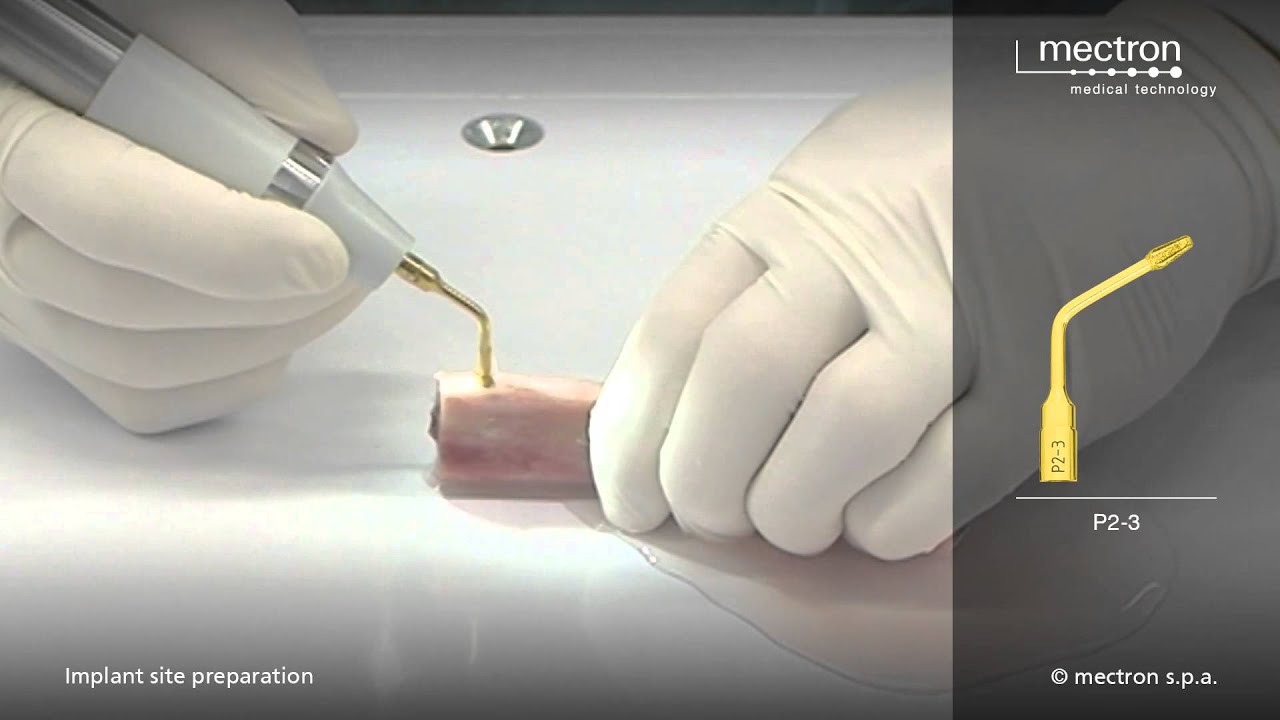PIEZOSURGERY - HANDS-ON - Implant site preparation - YouTube