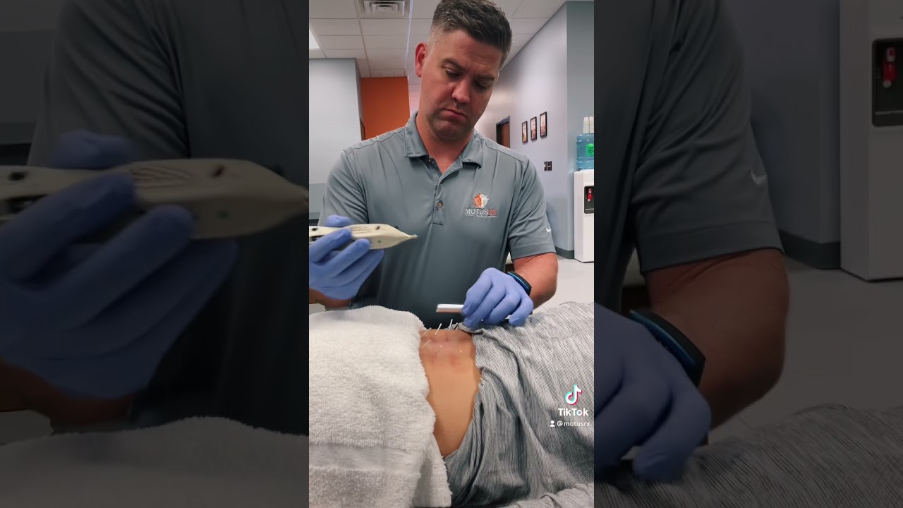 Low Back Dry Needling and STEM - YouTube