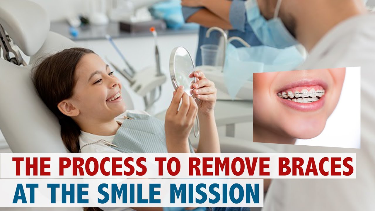 The Process to Remove Braces at The Smile Mission - YouTube