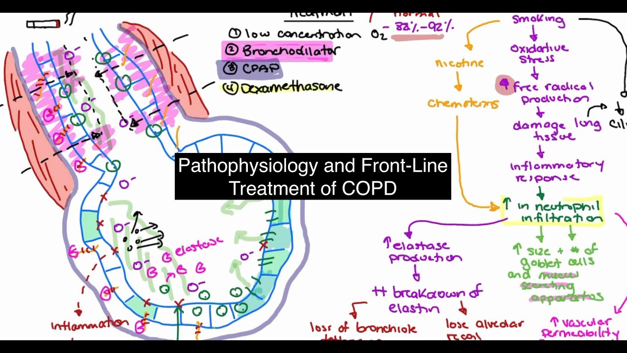 Pathophysiology and Treatment of COPD - YouTube