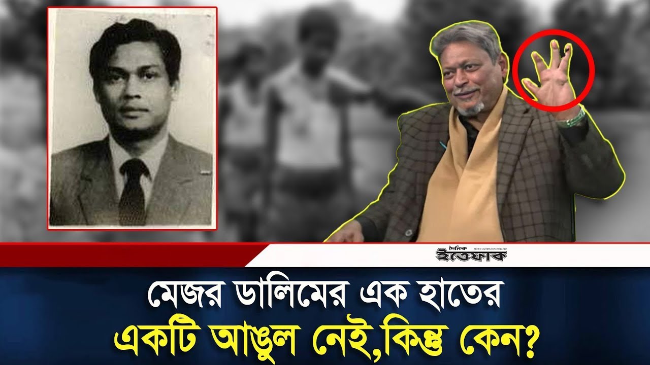 মেজর ডালিমের এক হাতের একটি আঙুল নেই,কিন্তু কেন? | Major Dalim | Daily ...