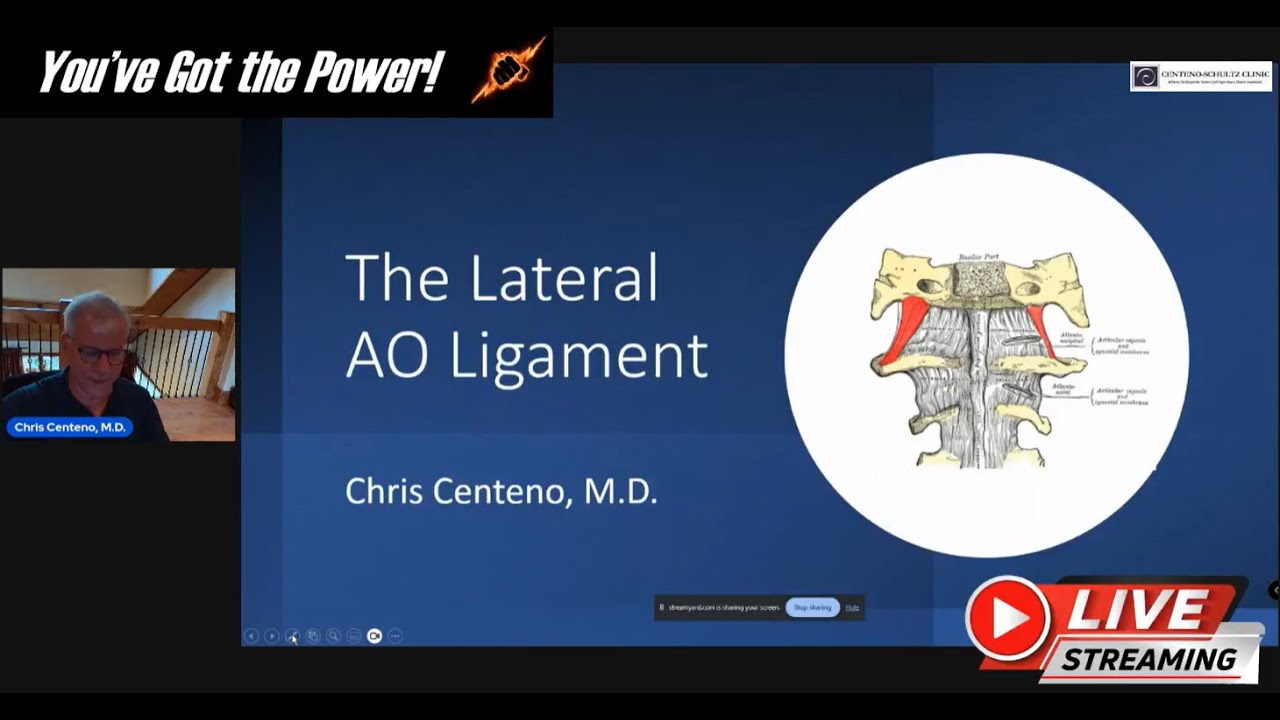 What is the Lateral AO Ligament? Is It Important in CCI? - YouTube