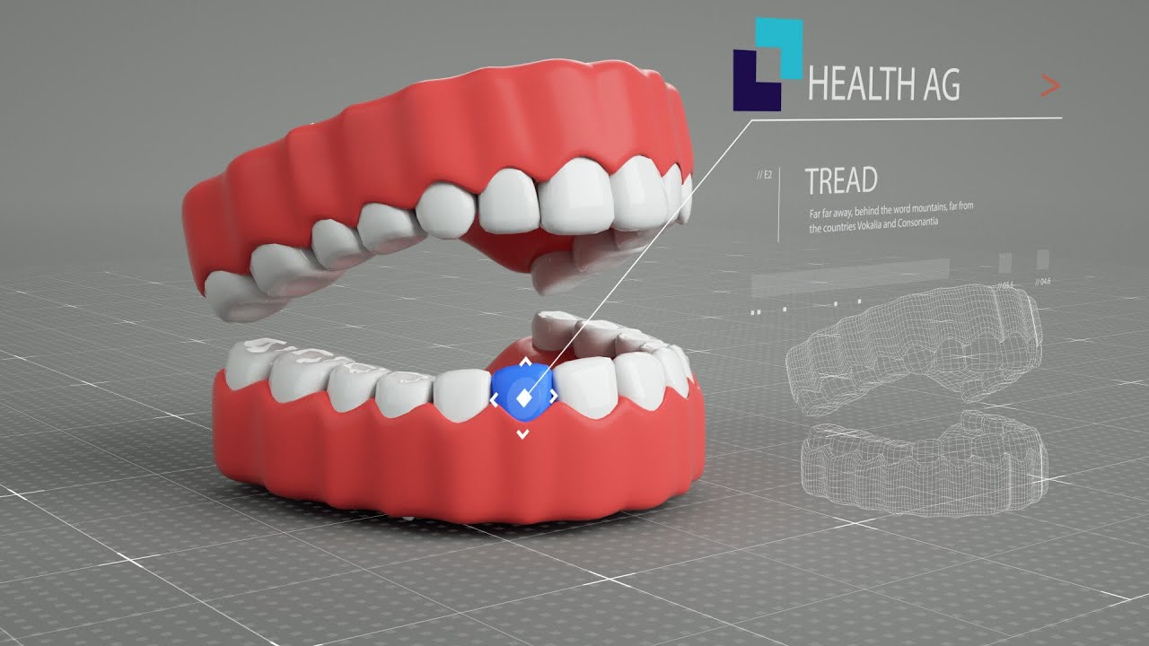 3d dental animation video - YouTube