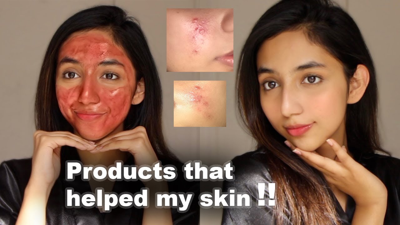 Products That Helped My Skin Updated Skincare Routine 2019 Youtube