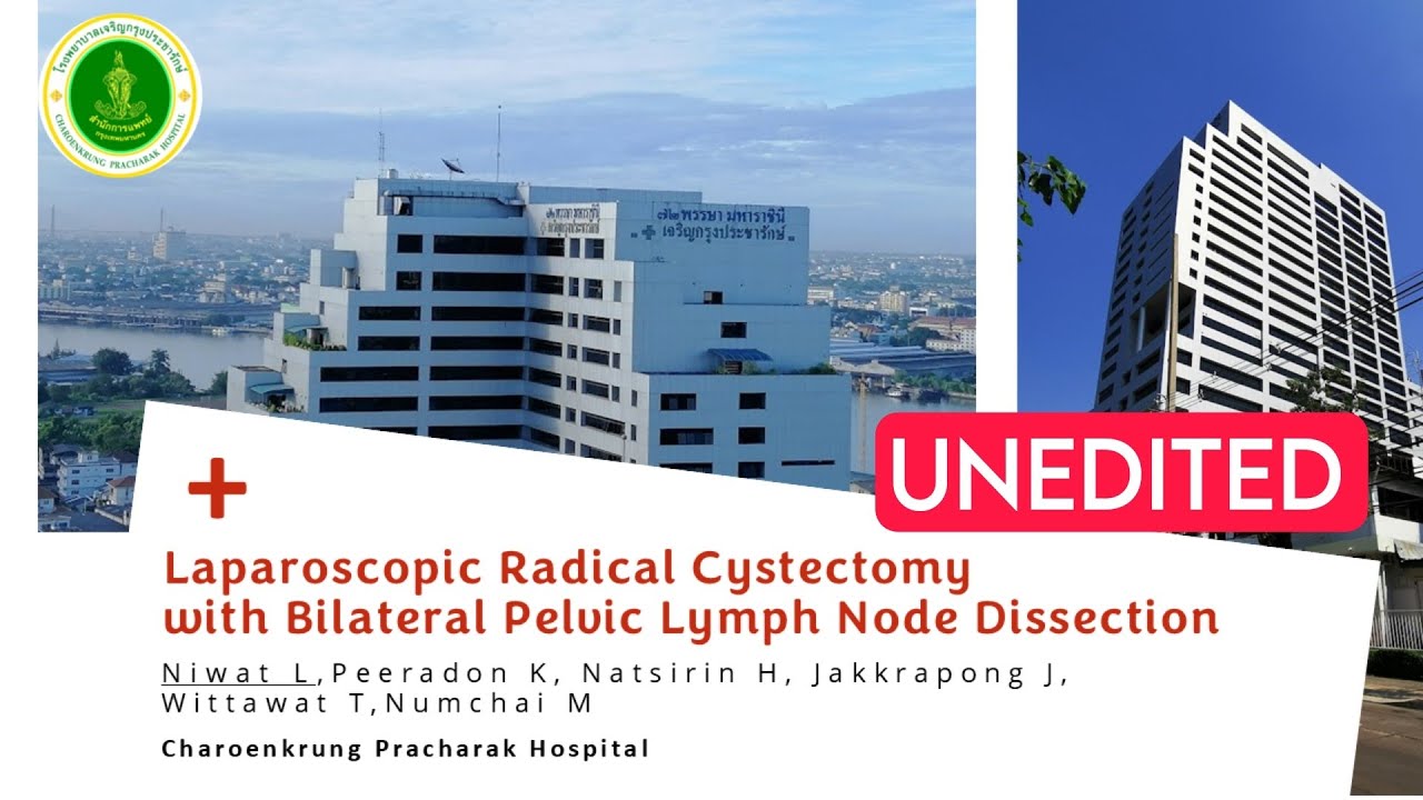 Laparoscopic Radical Cystectomy with bilateral pelvic lymph nodes ...