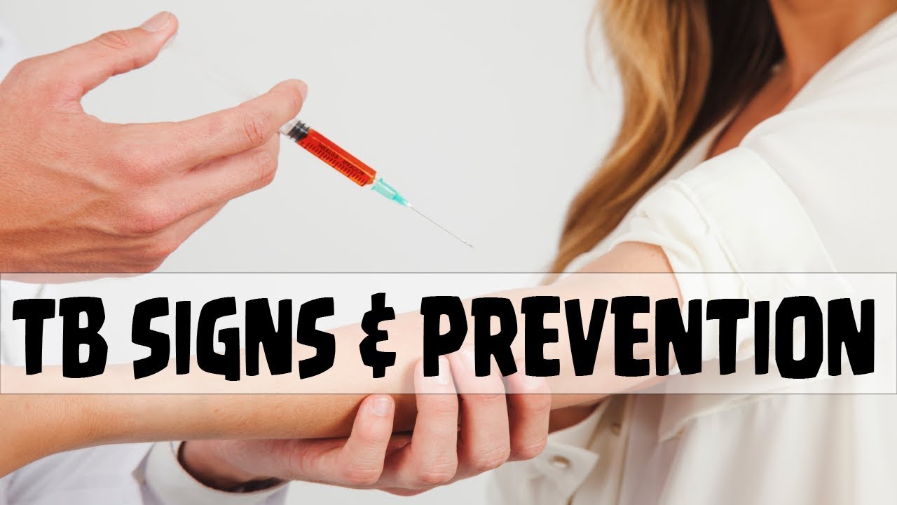 TB Signs and control | You must need to know these things - YouTube