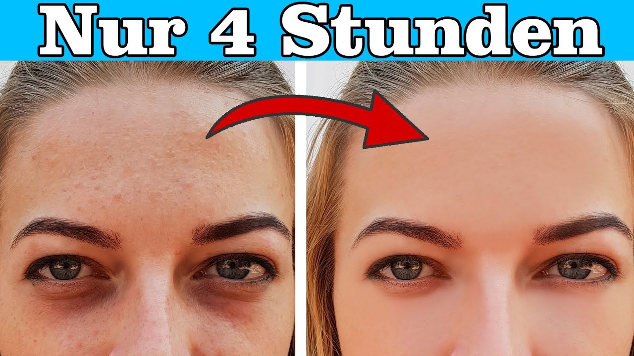 THIS is what happens to your Body when you Sleep only 4 Hours a Night 💥 ...