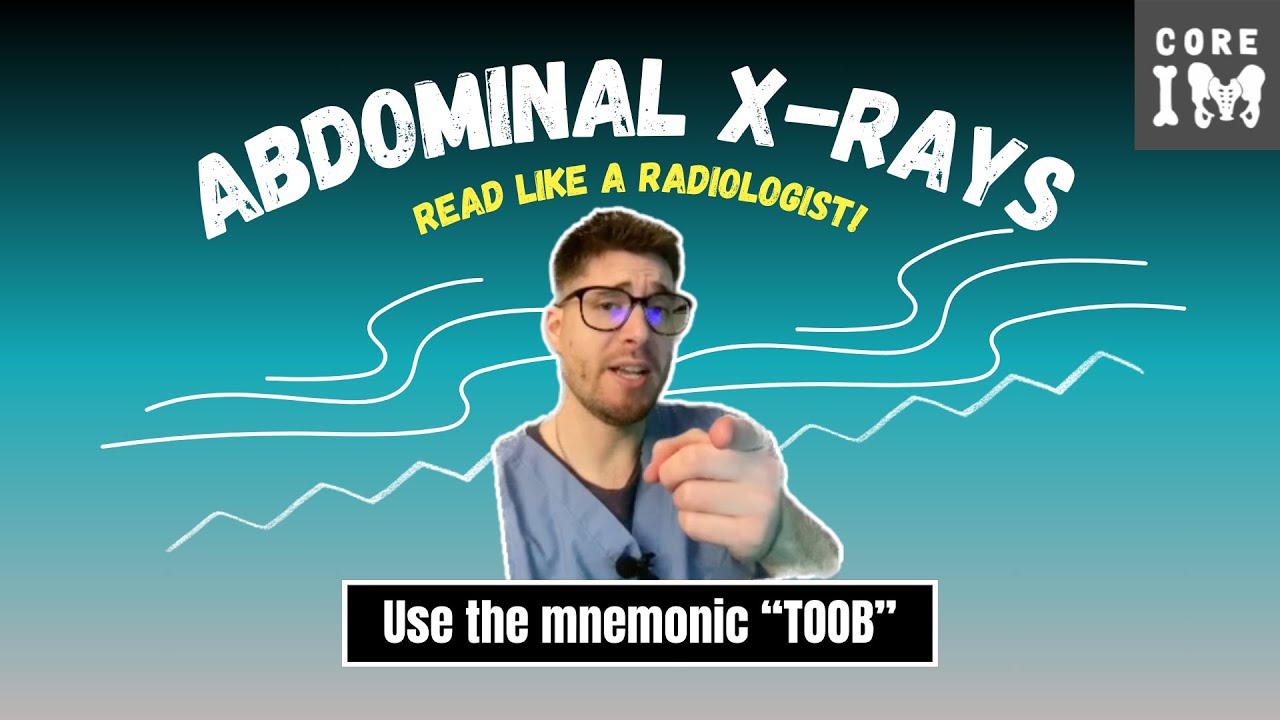 Read an Abdominal X-ray like a Radiologist! - YouTube