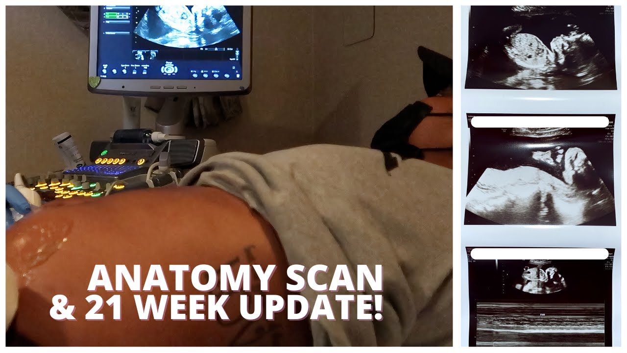 21 week pregnancy update + anatomy scan for baby #2!! - YouTube