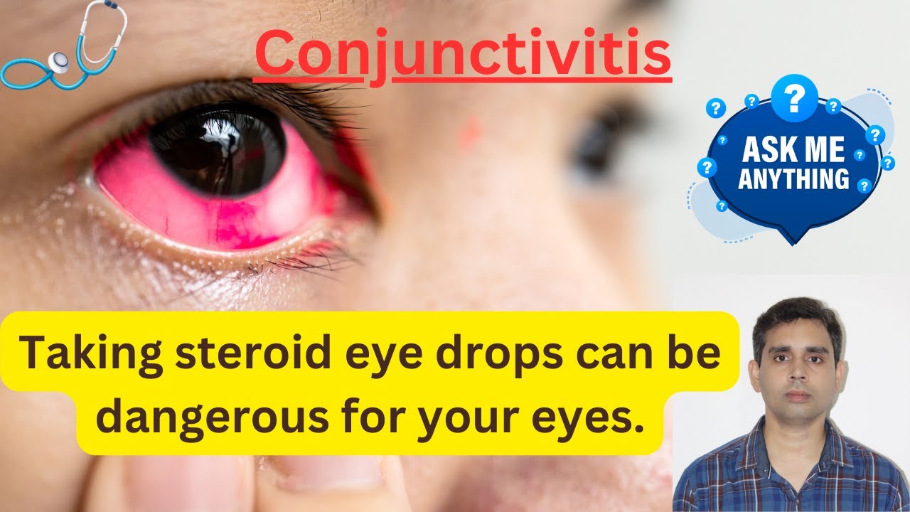 Conjunctivitis, its treatment and FAQs - YouTube