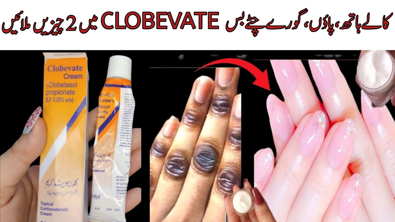 Add 2 Things In Clobevate Cream | clobevate farmula For Hand Foot ...