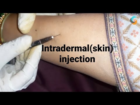 intradermal or skin injection - YouTube