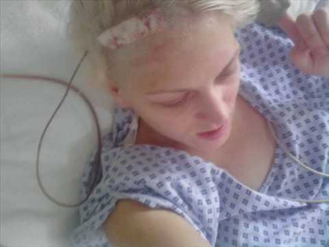 Idiopathic intracranial hypertension (IIH) - YouTube