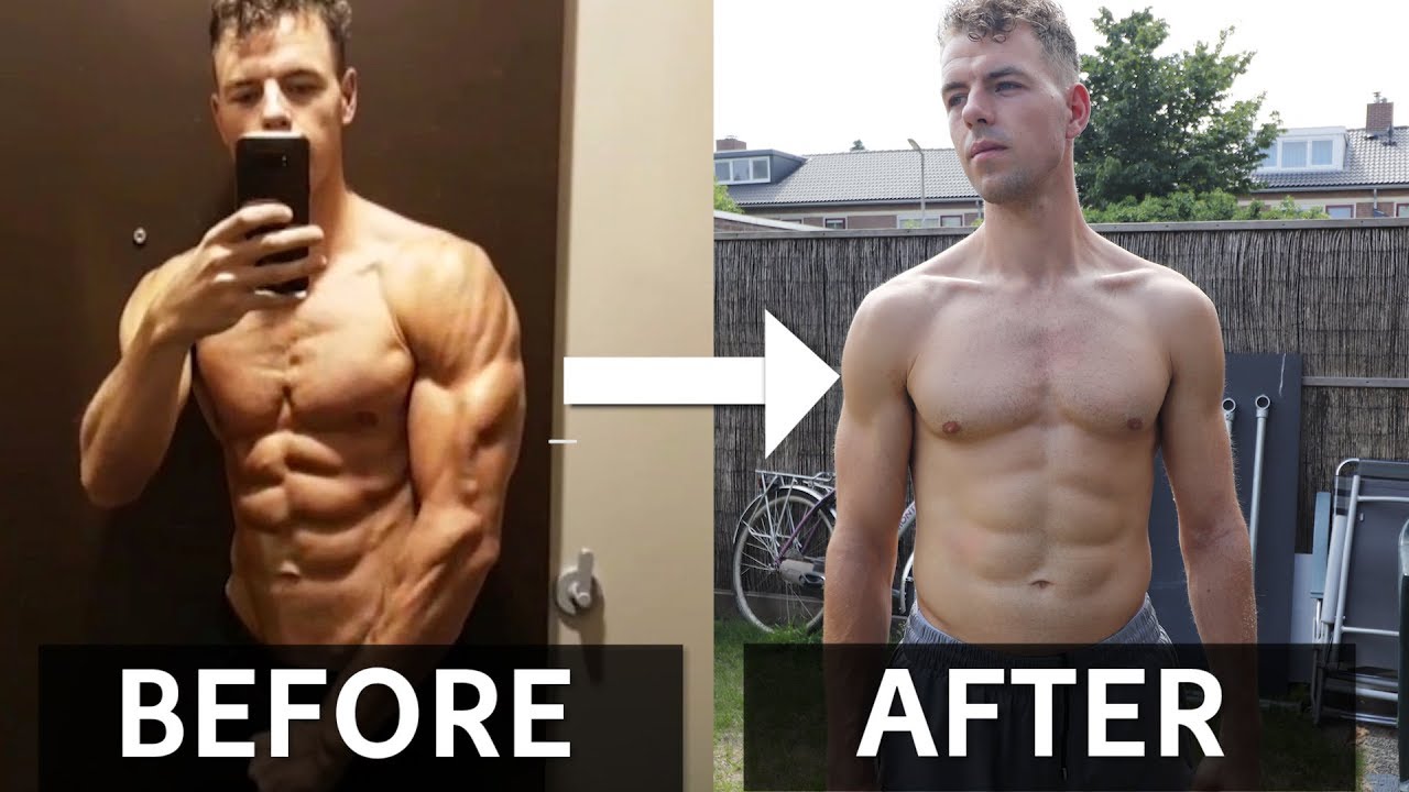 From Muscular To Skinny | Mindblowing 6 weeks Arm Cast Results - YouTube