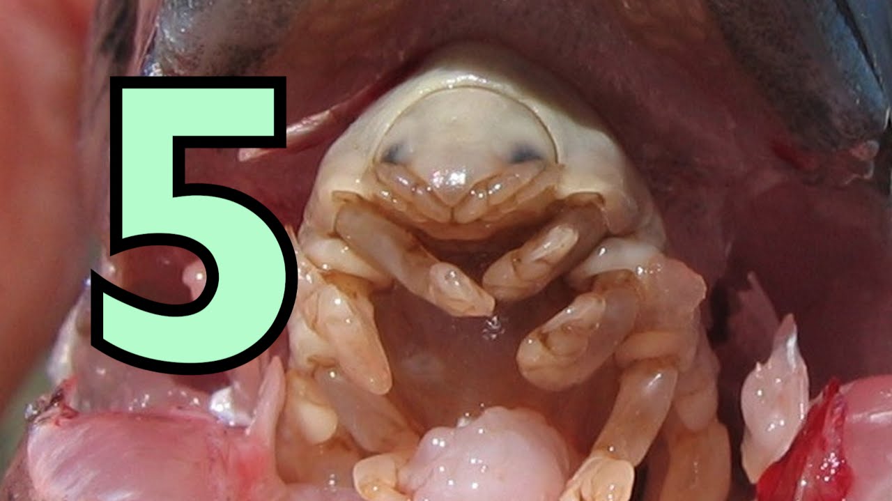 5 Nasty Parasites | Disturbing Things That Could Be Living Inside you ...