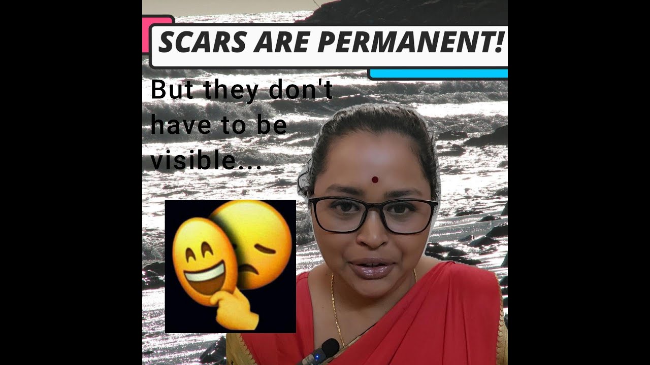 Scar series part 1 - YouTube
