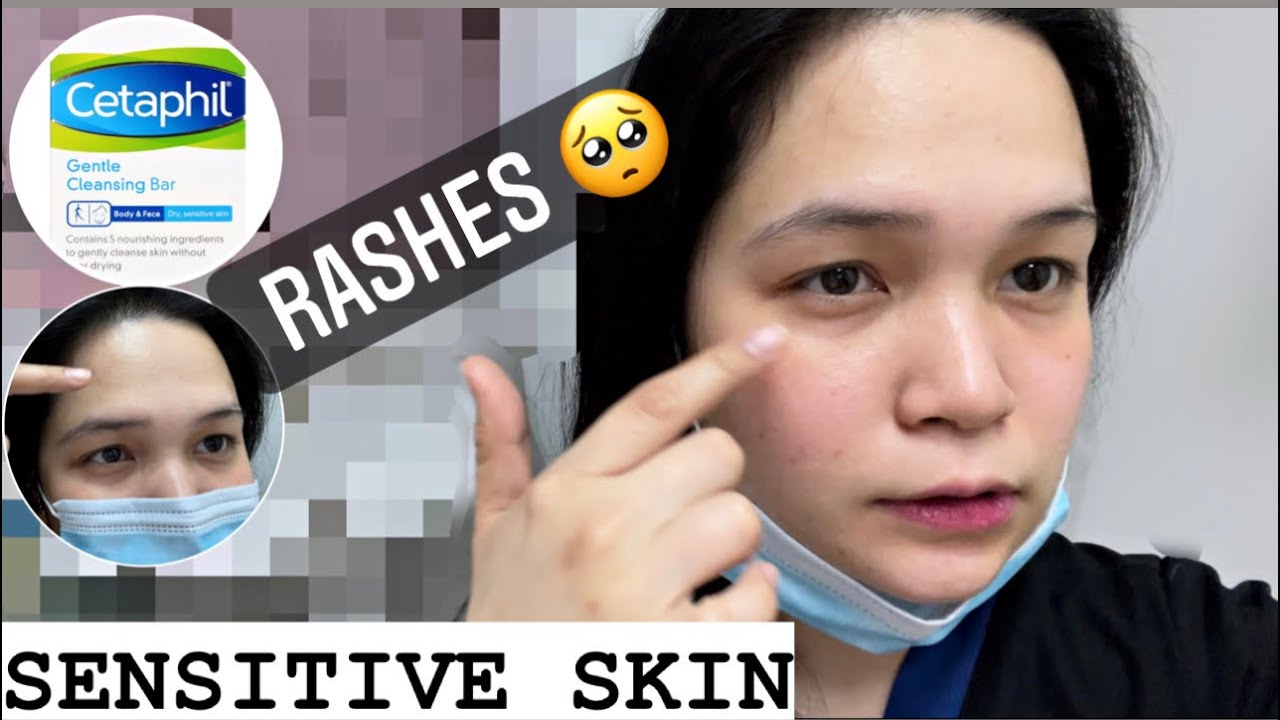 SKIN ALLERGY | Sa mukha pa talaga 🤭 | Kain pa ng malansa | Jeddah OFW ...