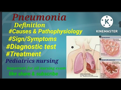 pneumonia | definition | causes |symptoms | treatment | pediatrics ...