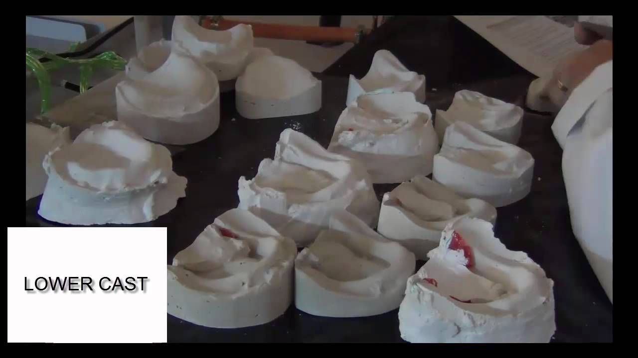 005 Complete dentures: LAB1 Quality Check- Primary Casts - YouTube