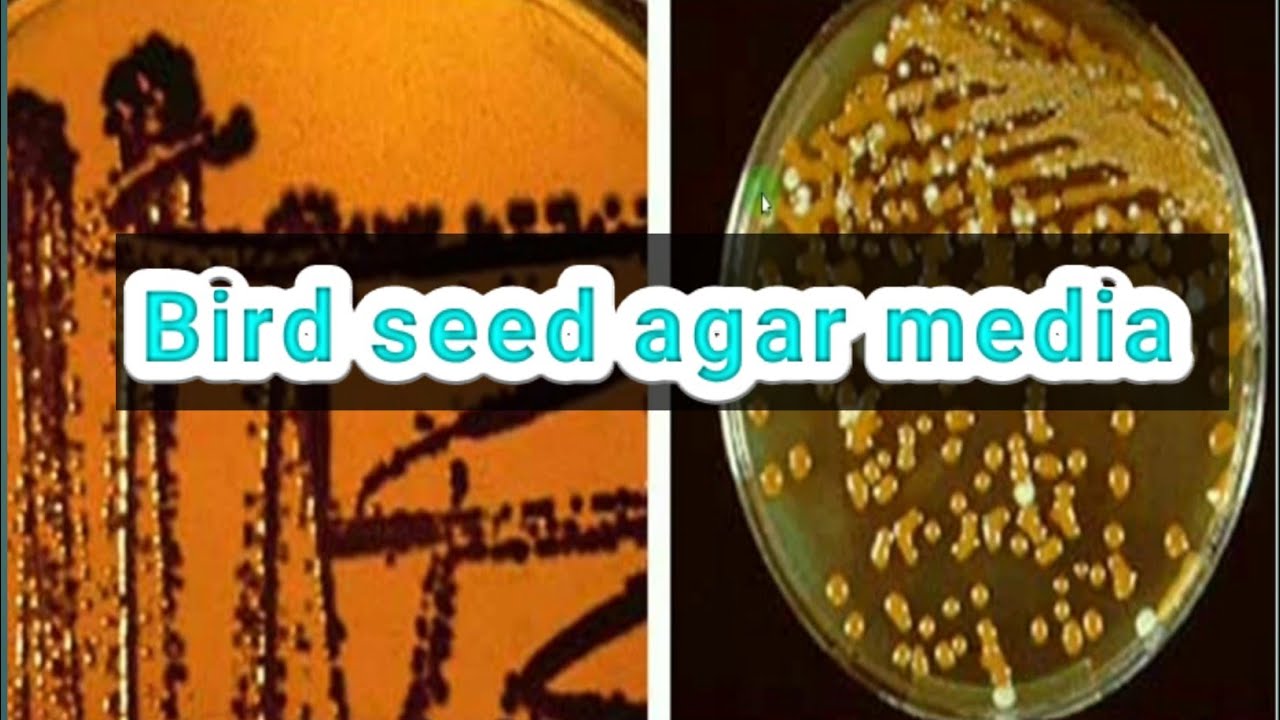 bird seed agar media or Cryptococcus neoformans slective media: Culture ...