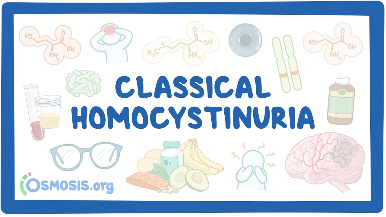 NORD - Classical Homocystinuria - YouTube