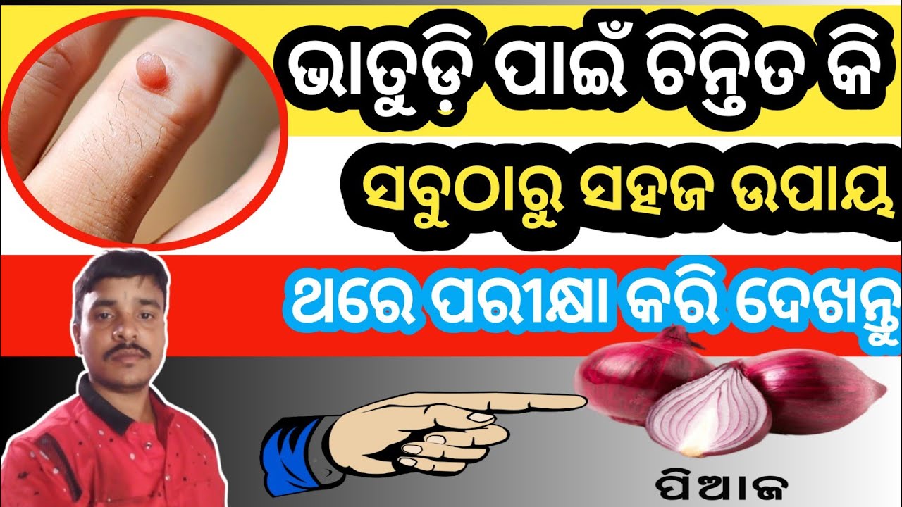 #wart,#bhatudi,bhatudi treatment in odia। ଭାତୁଡି କୁ ଦୂର କରିବାର ସହଜ ଘରୋଇ ...