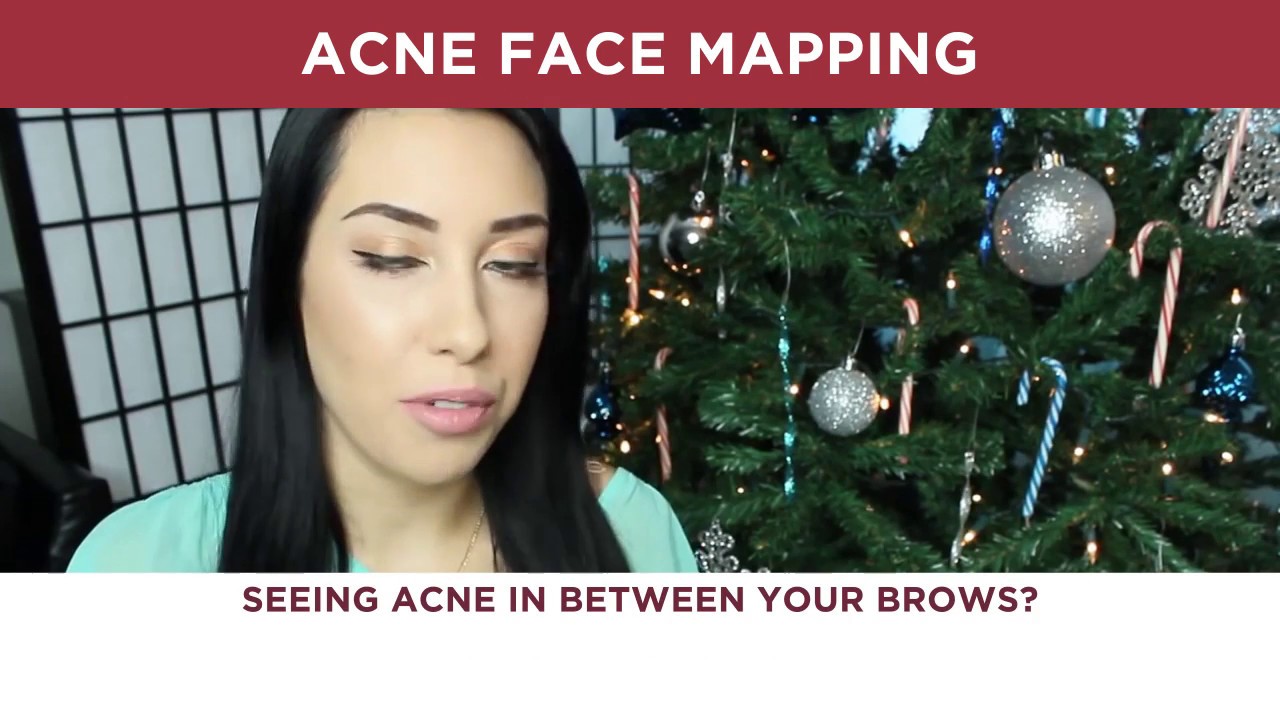 Acne Face Mapping - YouTube