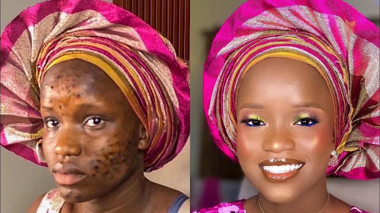 CLIENT MAKEUP TRANSFORMATION FT MAKEUP ON ACNE|DARK SPOTS| COPYRIGHT ...