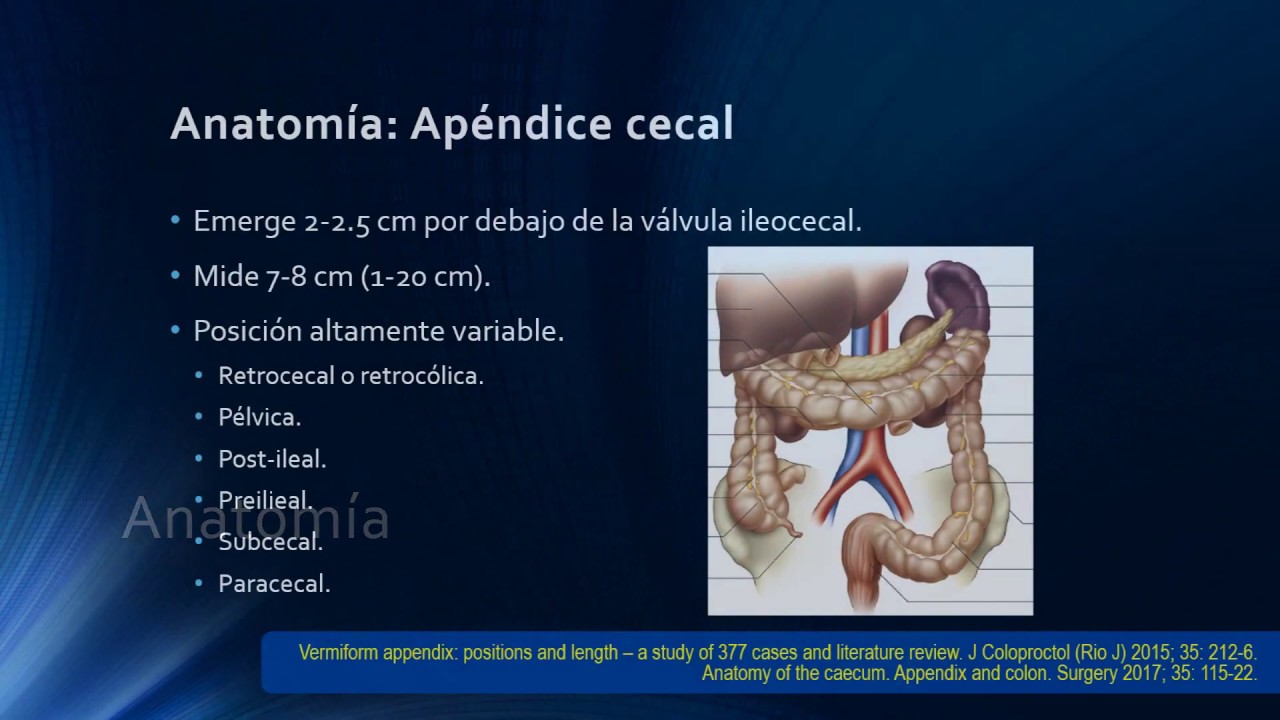 Apendicitis aguda - Módulo 2: Anatomía, fisiología y fisiopatología ...