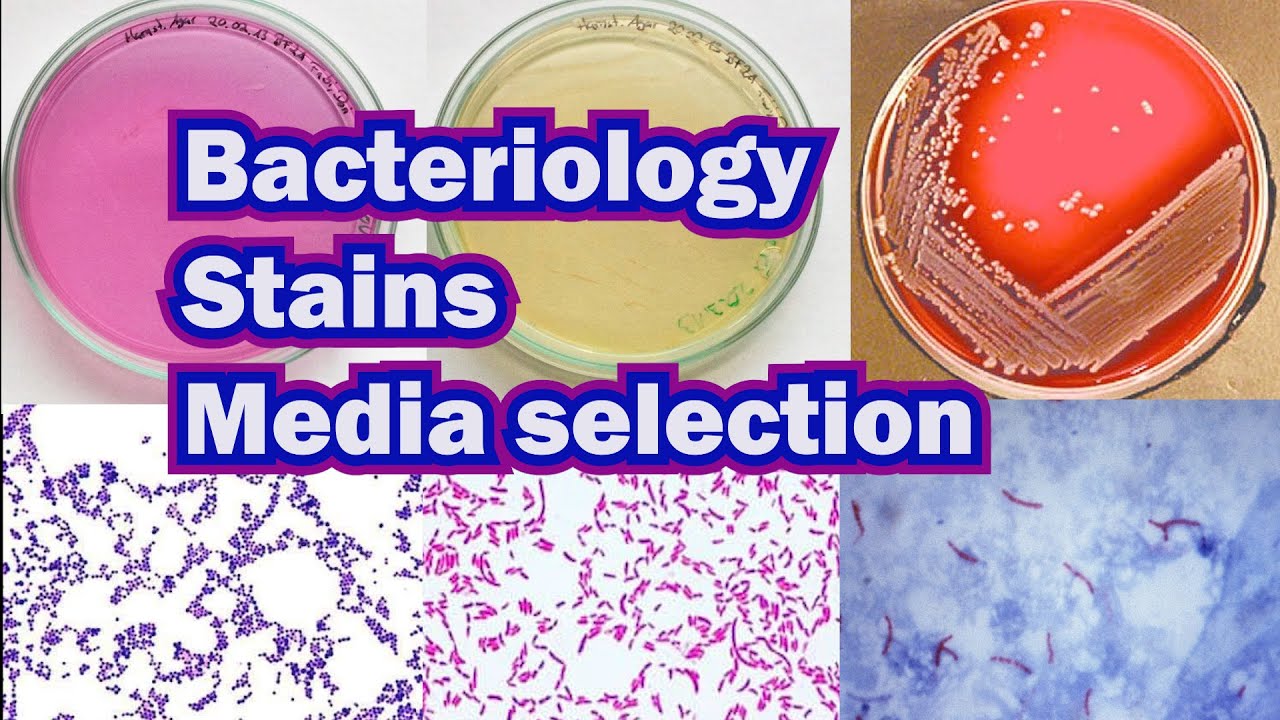 BACTERIOLOGY SAMPLE PROCESSING STAINS & PLATING - YouTube