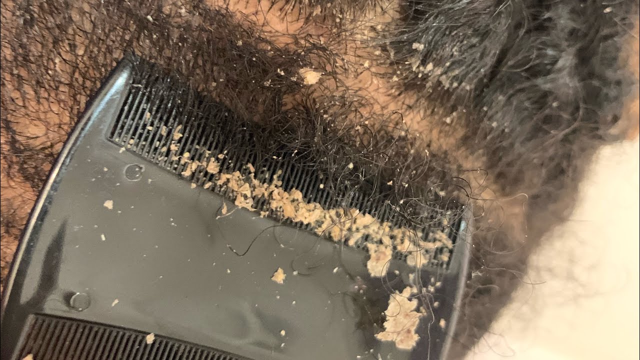 Back Flakes 🙌🏾 - YouTube