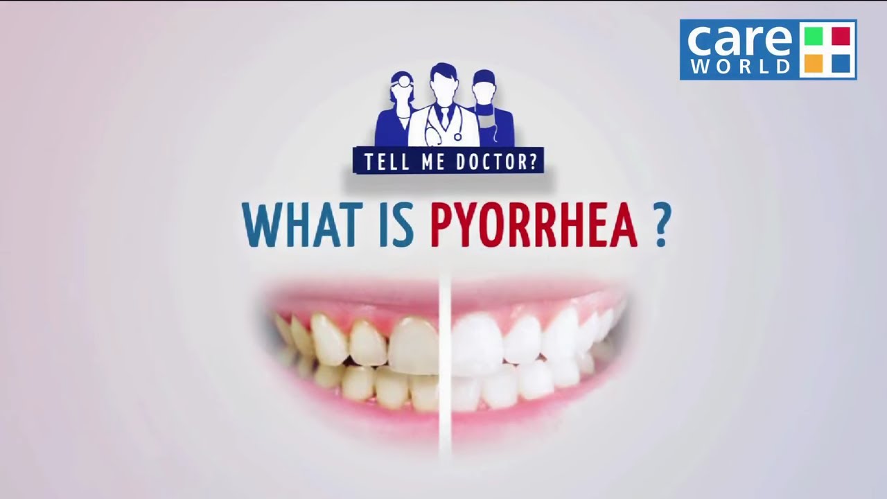 What is Pyorrhea? - Dr. Kapil Sharma - Tell Me Doctor - YouTube