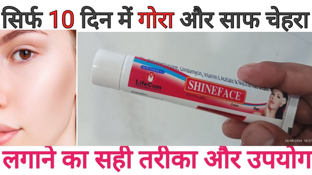 shine face cream review| shine face cream use | side effect - YouTube