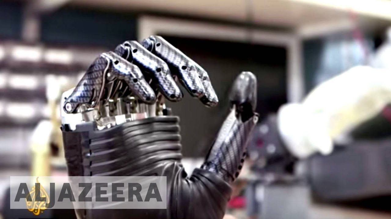 Bionic arm: A pioneering union between man and machine - The Cure - YouTube
