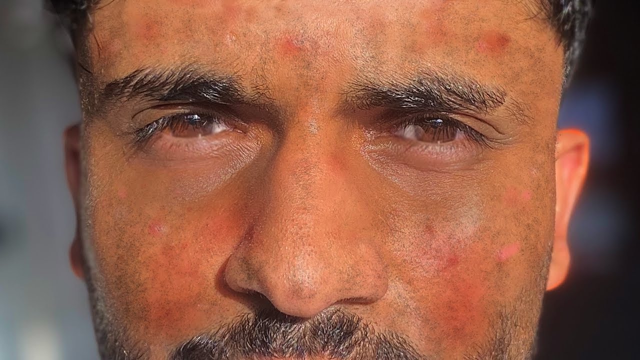 Why You Feel Disgusting in Your Own Skin - YouTube